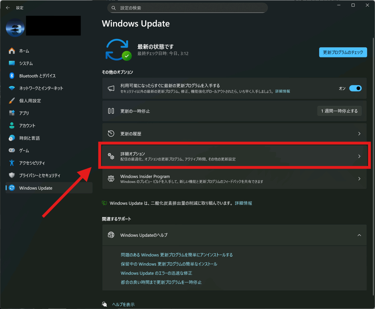 【PC動作が重い方へ】Windows 11を劇的に高速化する設定5選：効果と手順の徹底解説 | XenoSpectrum